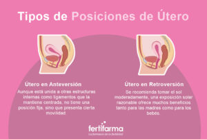 Útero en Anteversión. Causas, Síntomas y Tratamiento