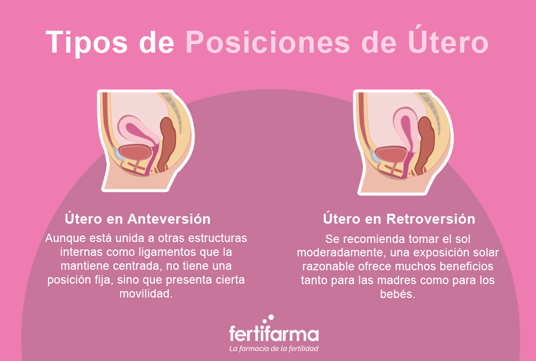 Útero en Anteversión. Causas, Síntomas y Tratamiento